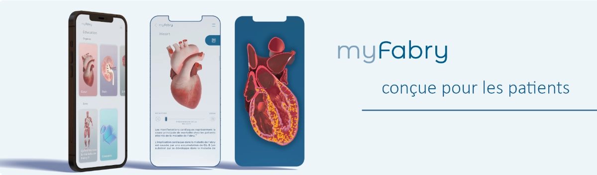 myfabry
